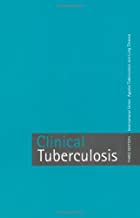 CLINICAL TUBERCULOSIS – Elex Academic Bookstore
